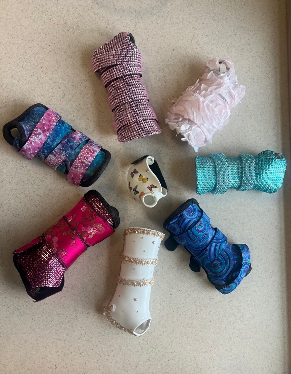 UPCYCLED & REPURPOSED WINNER – Bedazzled Occupational Therapy Hand ...