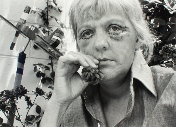 Facelift from the exhibition Anne Noggle: Self Portraits | Artwork Archive